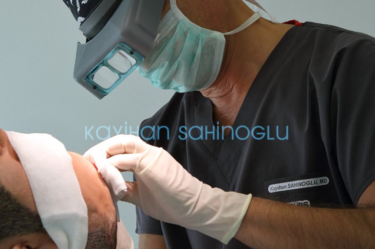 FUE Hair Transplant in Turkey | Dr. Kayihan Sahinoglu